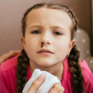 Nose Bleeds - Paediatric ENT